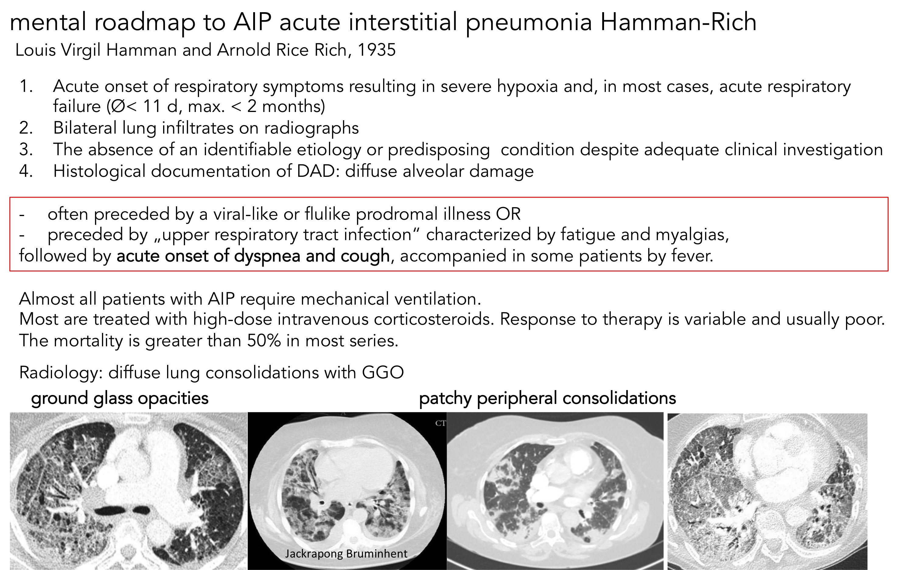 mental roadmap to AIP acute interstitial pneumonia Hamman-Rich incl DDx ...