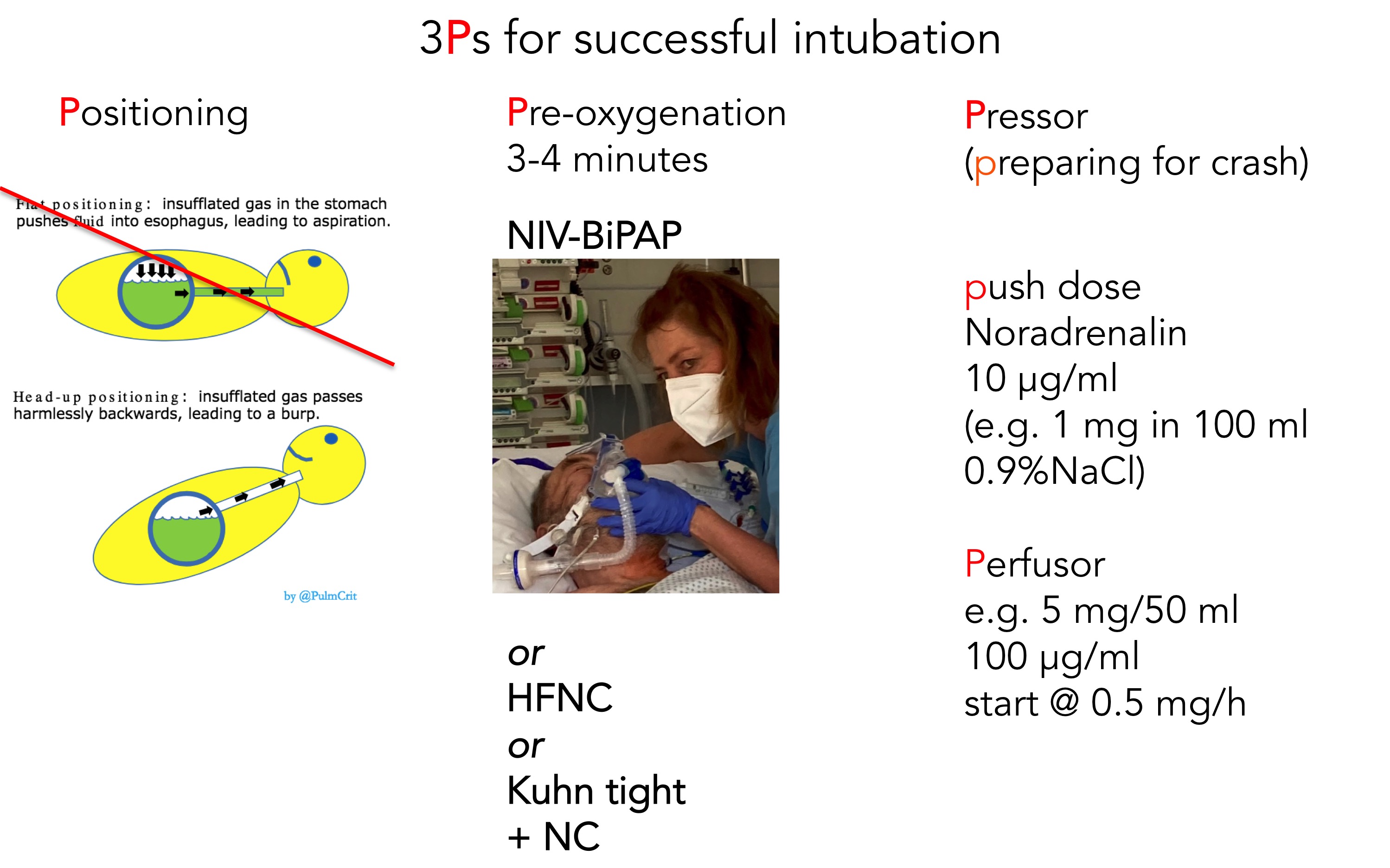 mental roadmap to intubation | VIGILANTIA et HUMILITAS
